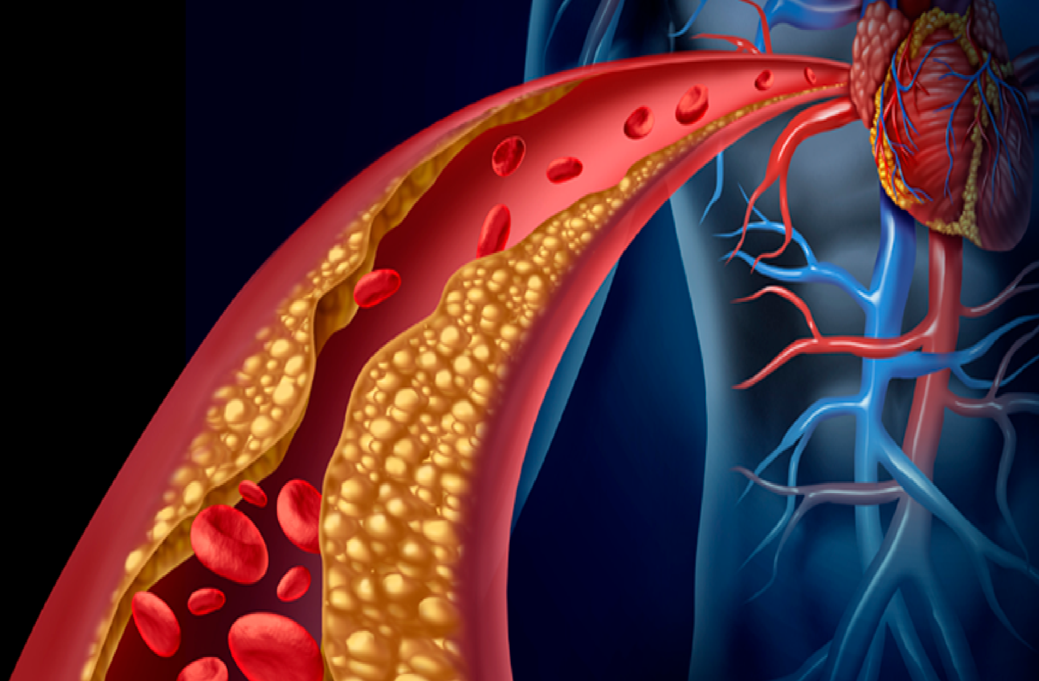 El colesterol - ¡Bienvenidos a Conectando Juntos!
