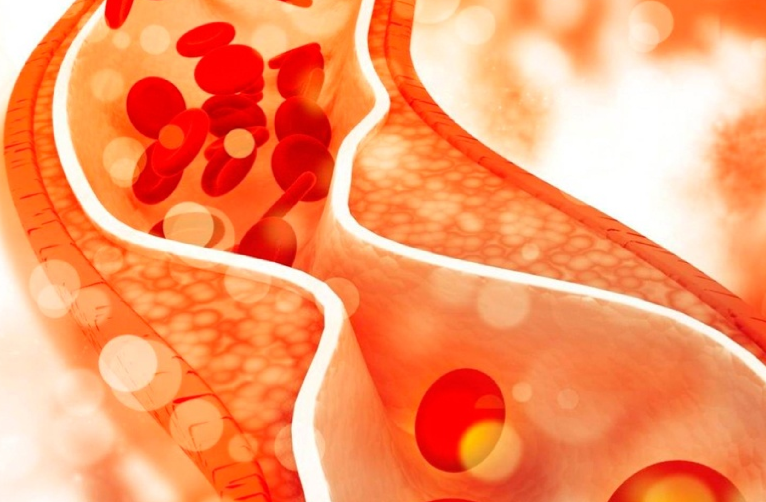 Diagnóstico del colesterol - ¡Bienvenidos a Conectando Juntos!